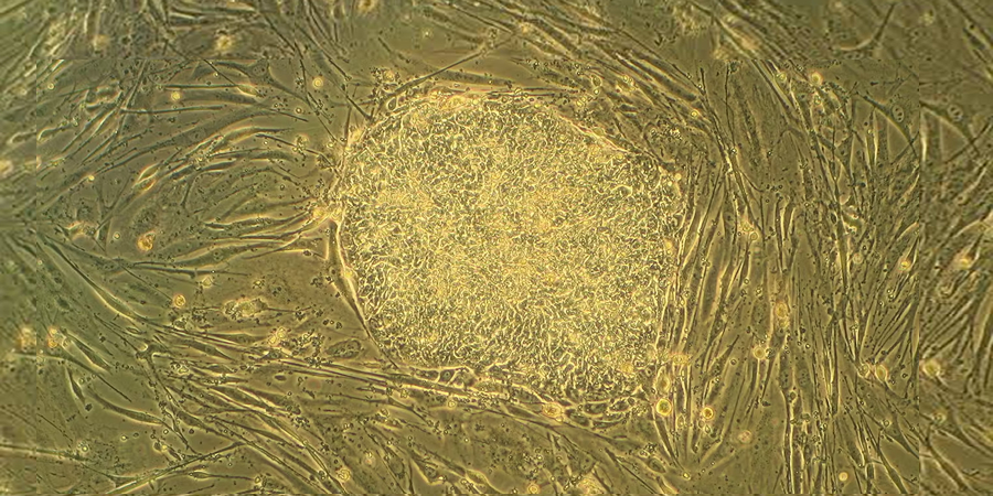 eFeedLink - Roslin: Stem cell study aids efforts to tackle ASF